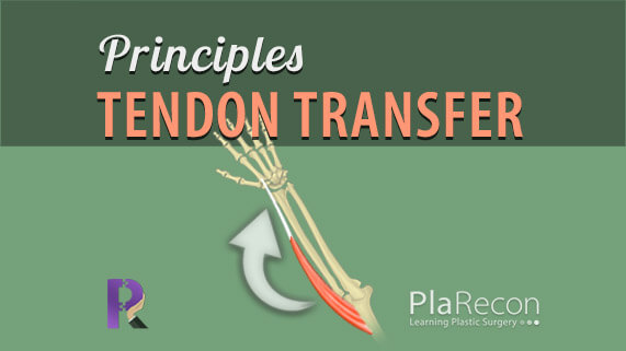 Tendon Transfer Principles [Mnemonics]