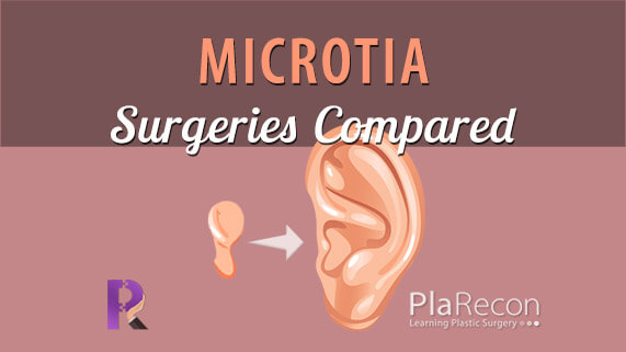 Microtia Ear Reconstruction- Brent, Nagata, Firmin- Comparison