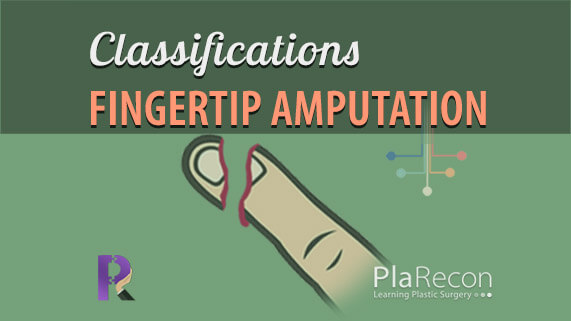 Fingertip Amputation Classifications